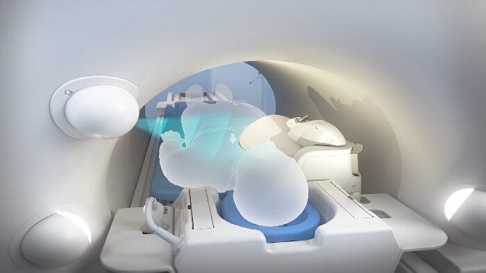 Smart Workflow solutions in MR | Philips